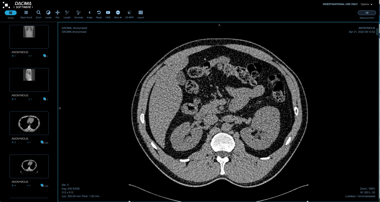 EDC - Dacima Software